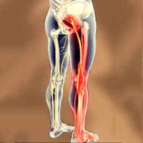 Shingles Symptoms Causes, Rash Treatment in Australia Sydney